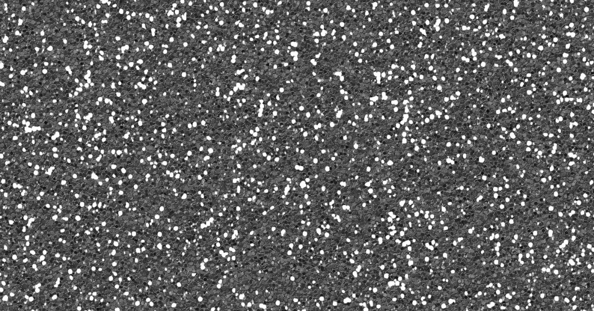 Looking Through the Static: Exploring the Link Between Visual Snow and ...